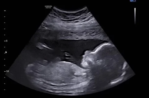 Baby Bumps & Beyond 4D Studio — Packages