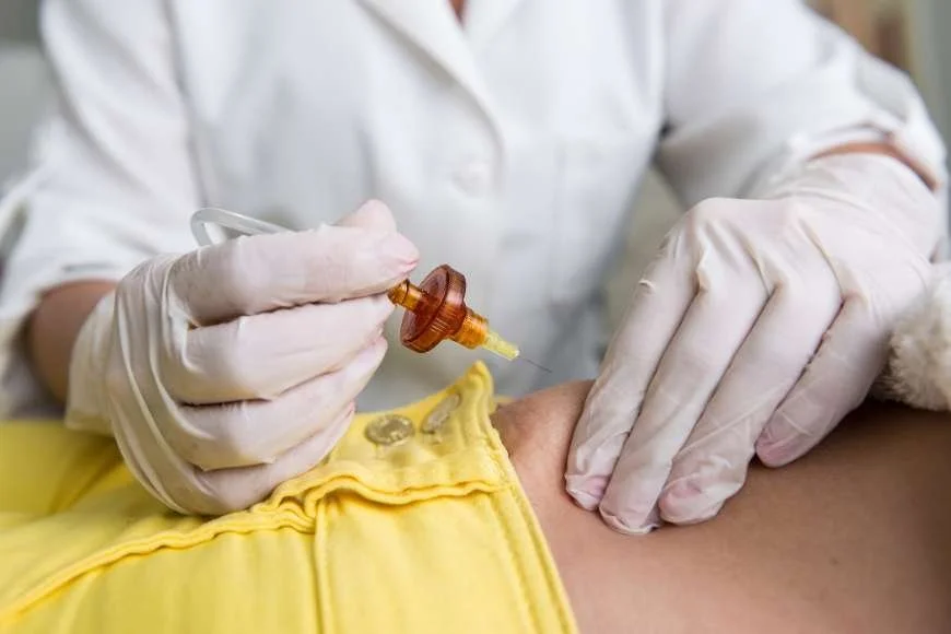 Carboxytherapy: Revitalise Your Skin — Pure Clinic