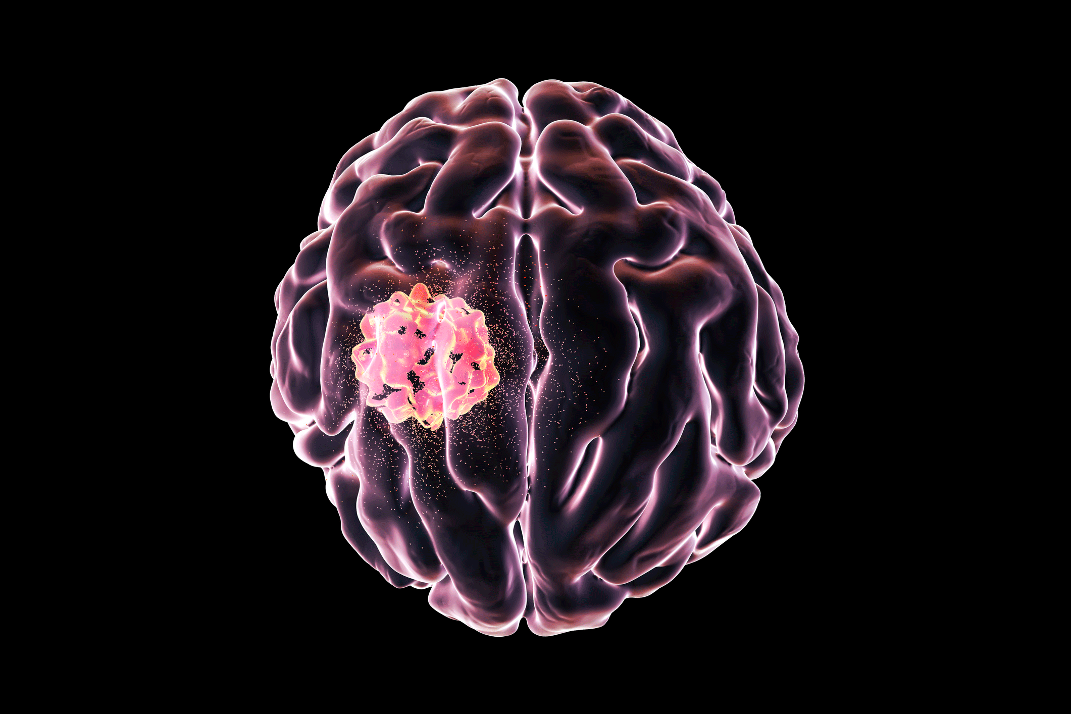 Lekhaj Daggubati, MD - Neurosurgery