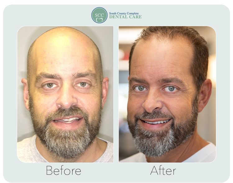 Dr. James Fetsch - South County Complete Dental Care, MO