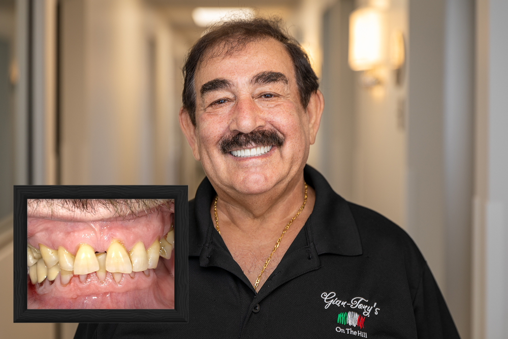Dr. James Fetsch - South County Complete Dental Care, MO