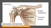Shoulder Centration: The Missing Piece In Shoulder Rehab — Solving Pain ...