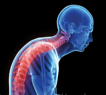 The Best Treatment For Neck Arthritis: Improving Mid Back Mobility ...