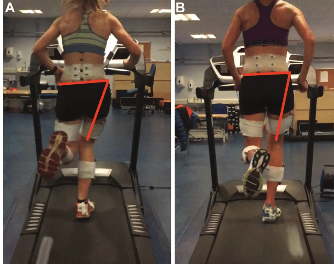 Lateral hip pain in Runners: Gluteal Tendinopathy overview — The Injury ...