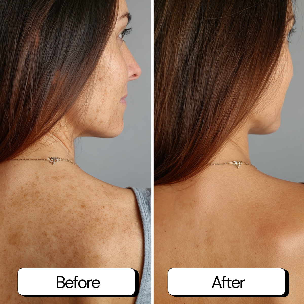 Pigmentation Removal Promotions at Skin Xclusive — Skin Xclusive