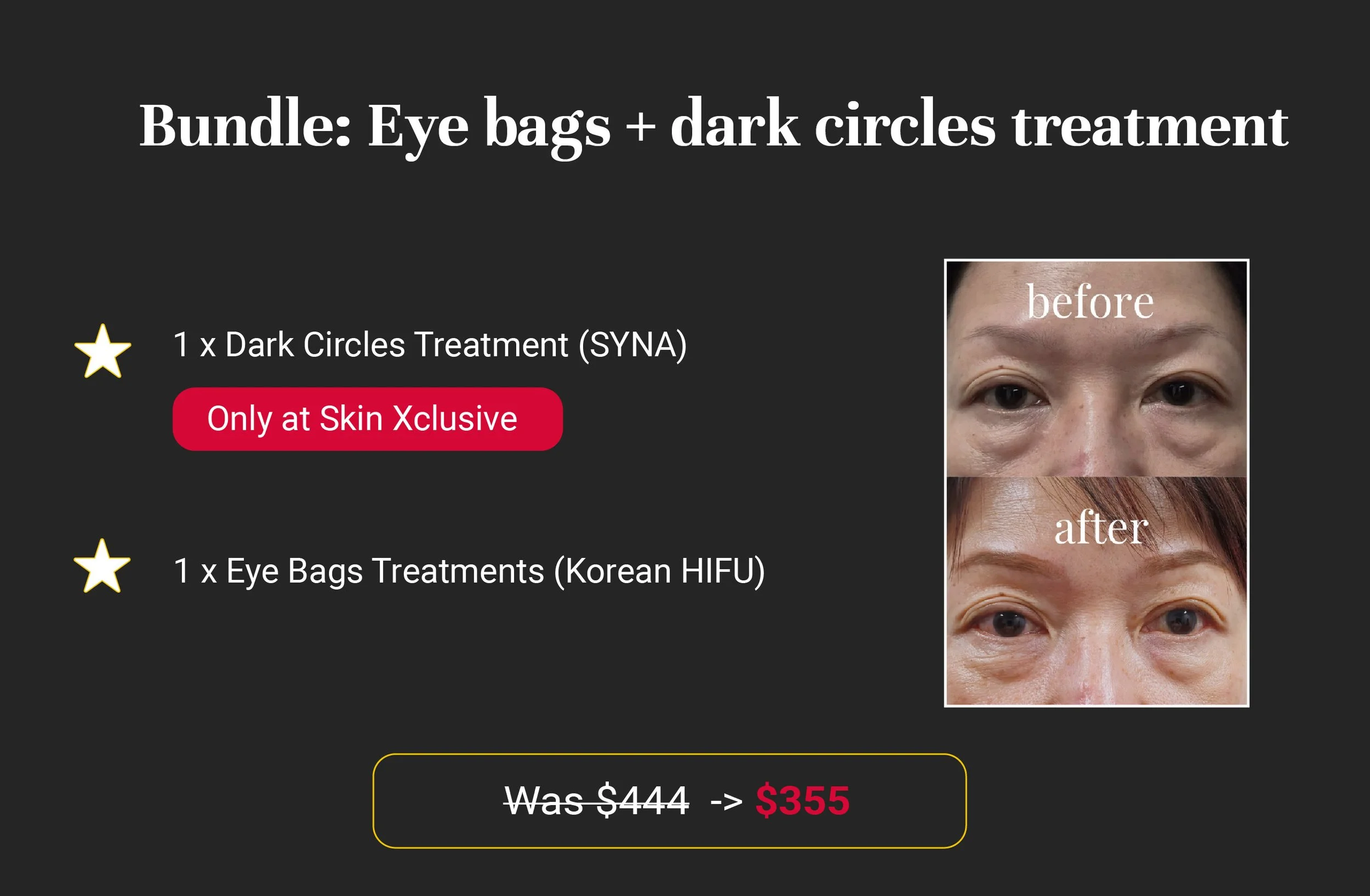HIFU Promotions at Skin Xclusive — Skin Xclusive