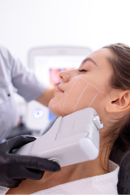 Double Chin Treatment — Skin Xclusive