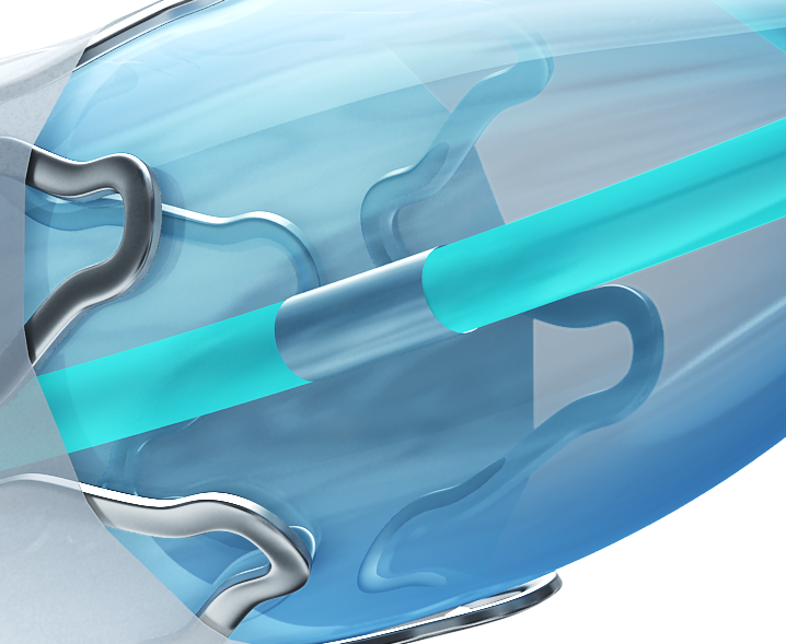 WILLIS™ Intracranial Stent Graft System — Microport Neuroscientific