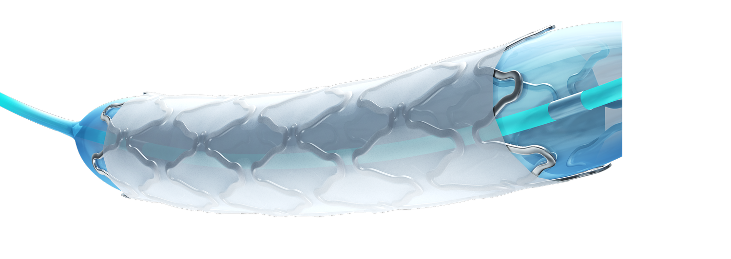 WILLIS™ Intracranial Stent Graft System — Microport Neuroscientific