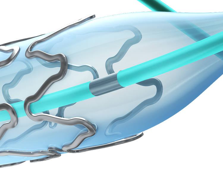APOLLO™ Intracranial Stent System — Microport Neuroscientific