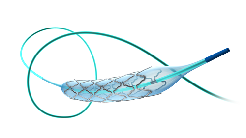 APOLLO™ Intracranial Stent System — Microport Neuroscientific