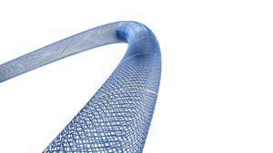 Tubridge™ Flow-diverting Stent Device — Microport Neuroscientific
