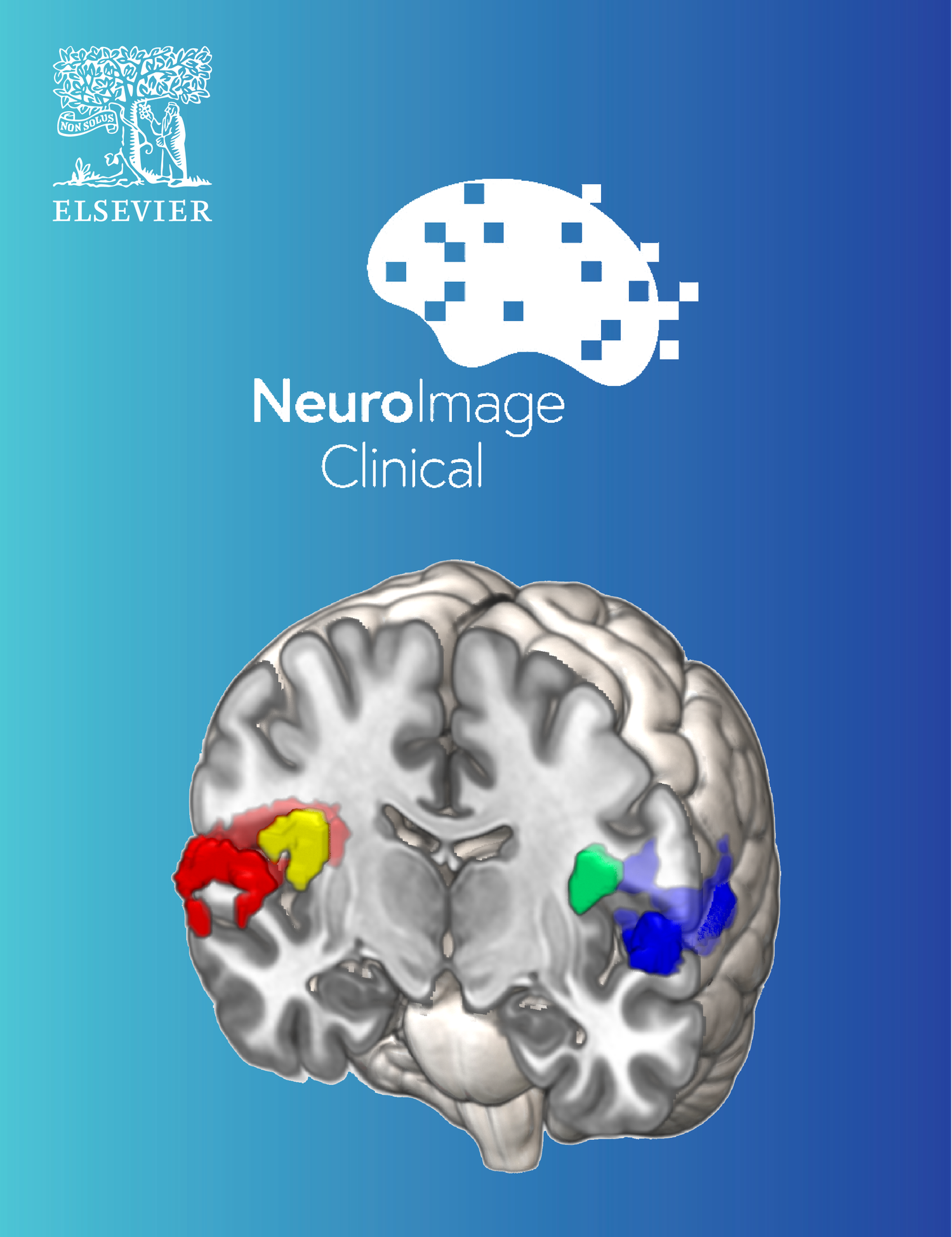 Scientific Evidence: 20+ Publications & 25+ Patents on Advanced Brain ...