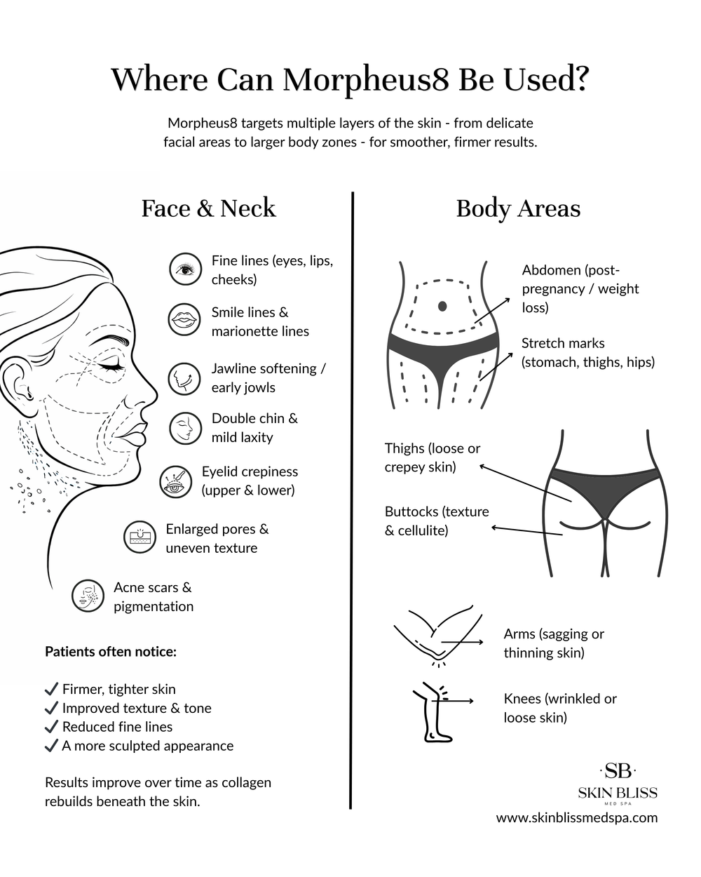Morpheus8 Treatment Areas: Face & Body