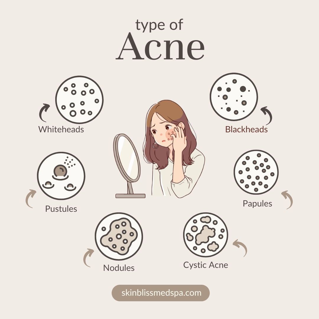 Truth About Treating Acne & Caring for Troubled Skin