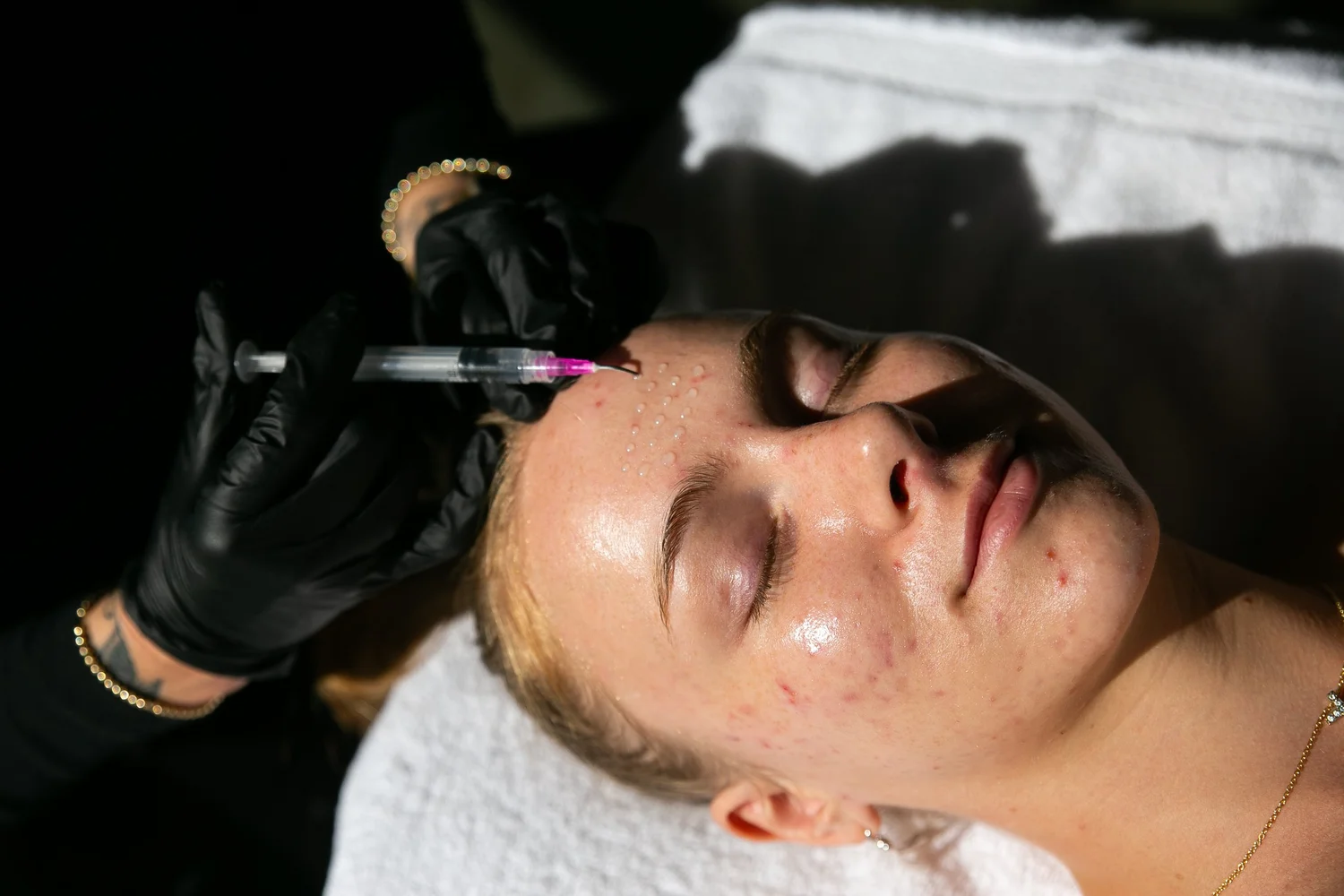 Factor Five RDS Peel: My Favorite Peel