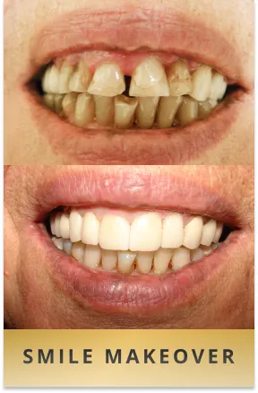 Kings Family Dental Group