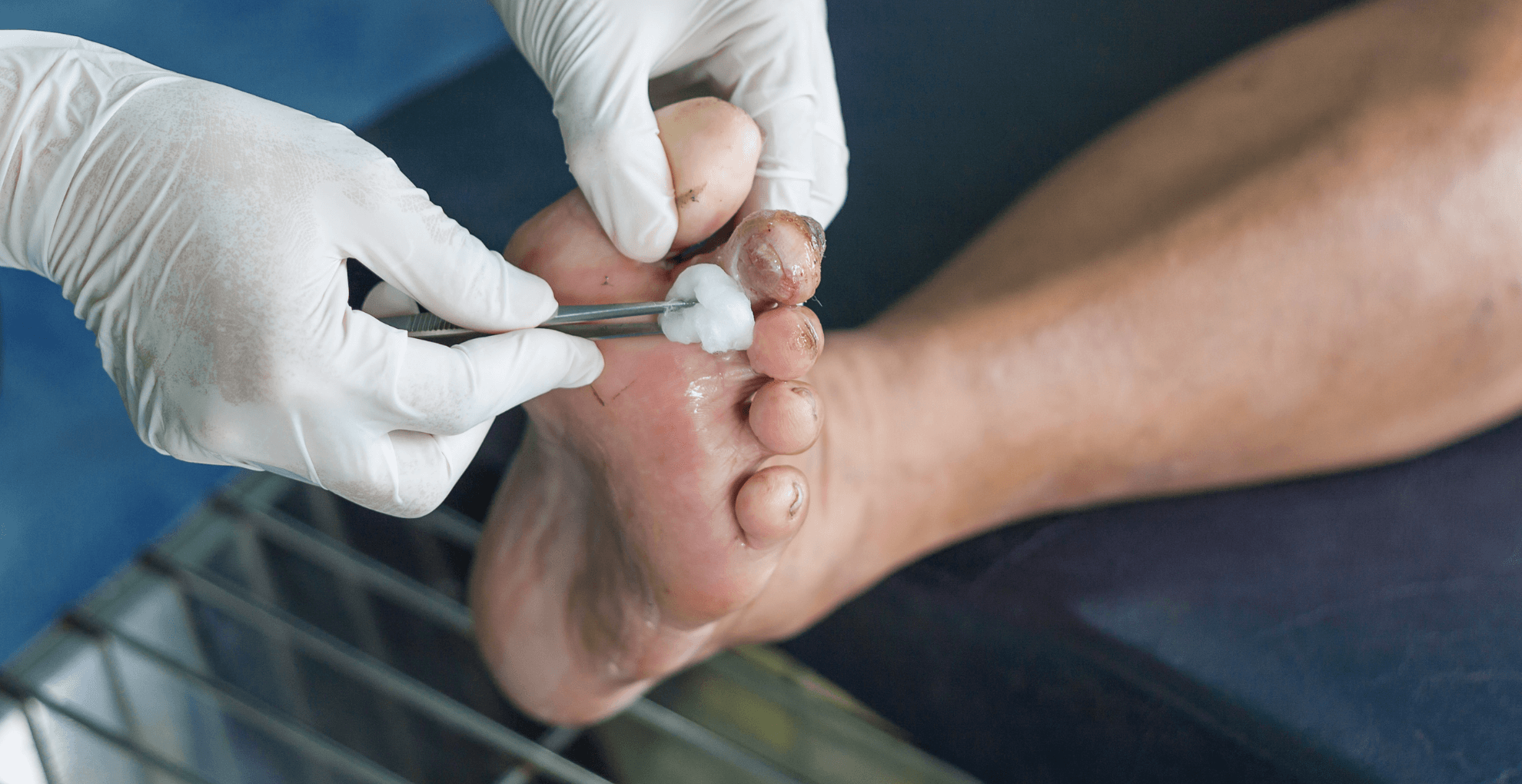 Comprehensive Podiatry Services | The Hills Foot Clinic in Sydney — The ...
