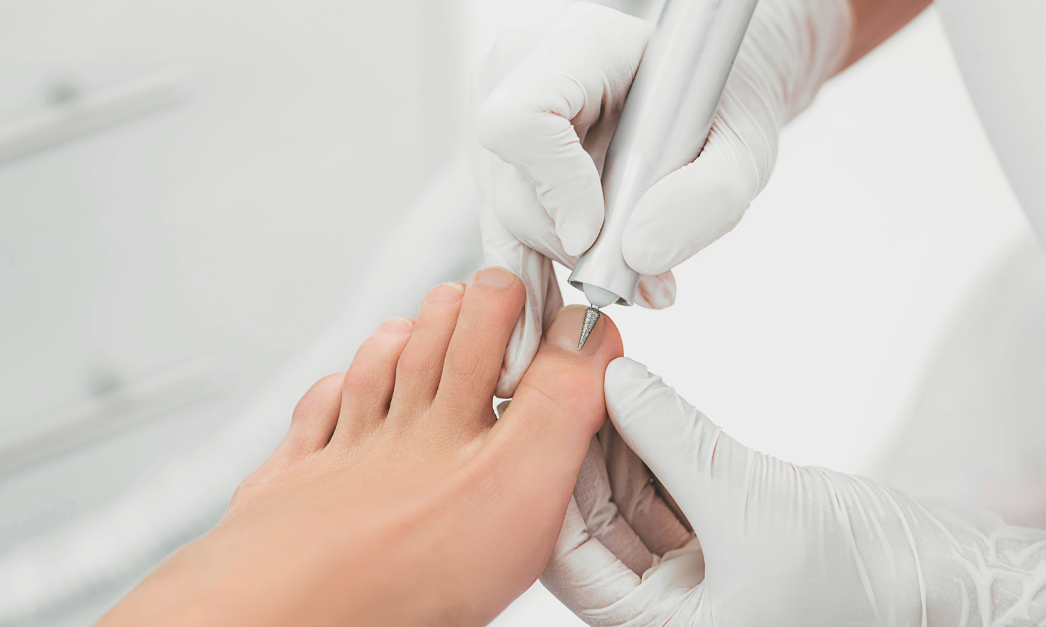 Medical Pedicure – Safe & Professional Foot Care — Ace Feet Podiatry ...