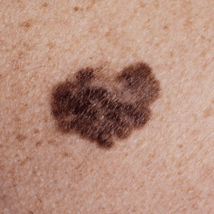Best Dermatologist in New Canaan | Dermatology New Canaan