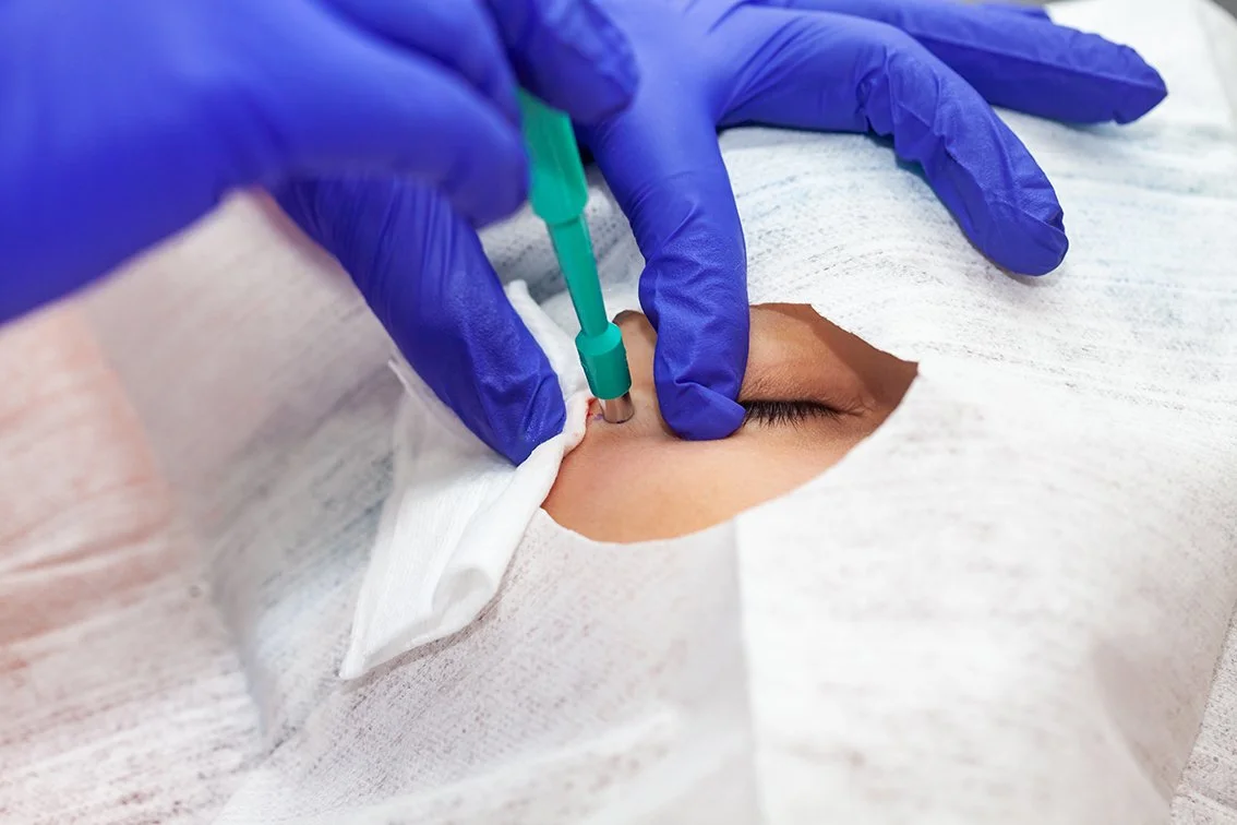 Biopsy & Surgical Excisions NSDL — Northern Sydney Dermatology NSDL ...