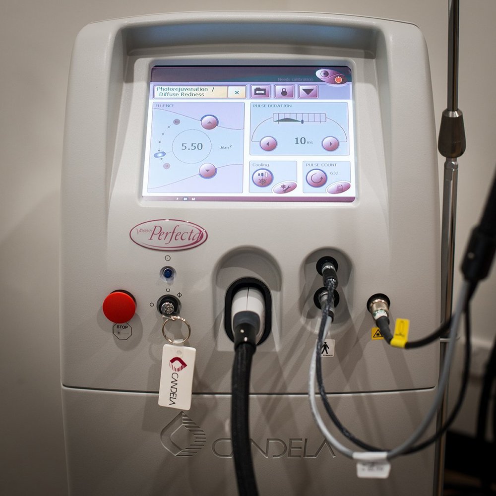 VBeam Perfecta® Pulsed Dye Laser — Northern Sydney Dermatology NSDL ...