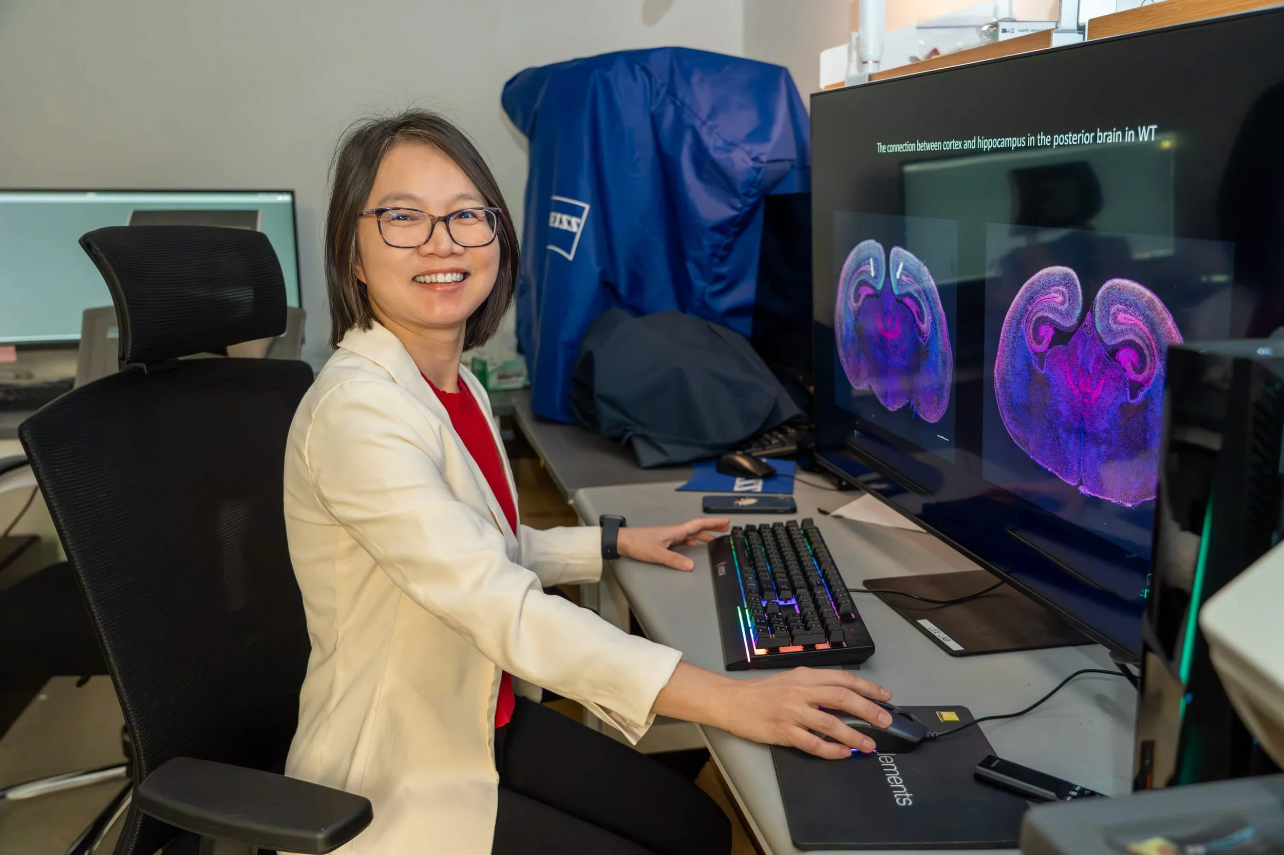 FOXG1 Research Center Team: Meet Dr. Liwen Li — FOXG1 Research Center