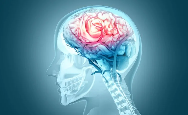 Concussions — UBMD Neurology