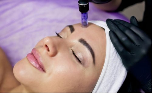 Microneedling | Enhance Skin Naturally — Book Now — CoCoAesthetic