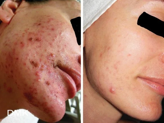 DMK Experts Granville Sydney — BioMed
