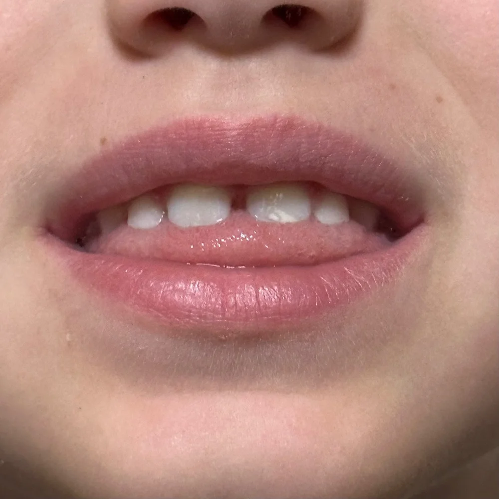 Understanding Lisps: A Parent’s Simple Guide to Clearer Speech ...