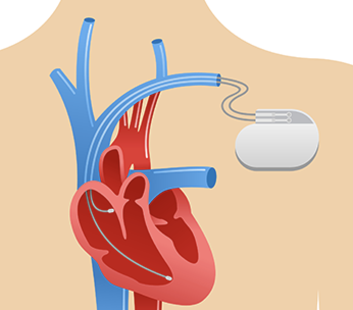 Services — Heartbeat Cardiovascular Medical Group