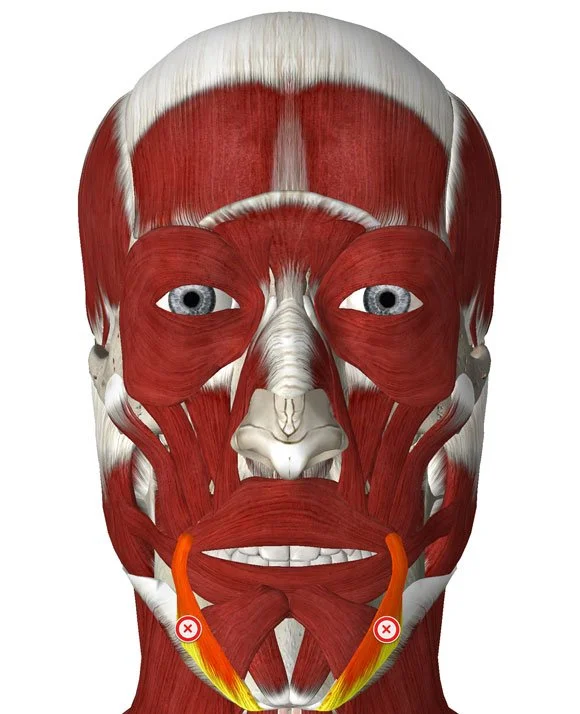 Botox for Marionette Lines | Panorama Dermatology Clinic