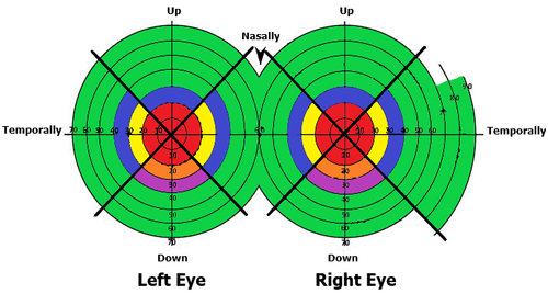 Rating Schedule for The Eyes | Find out how the VA rates the Eyes and ...