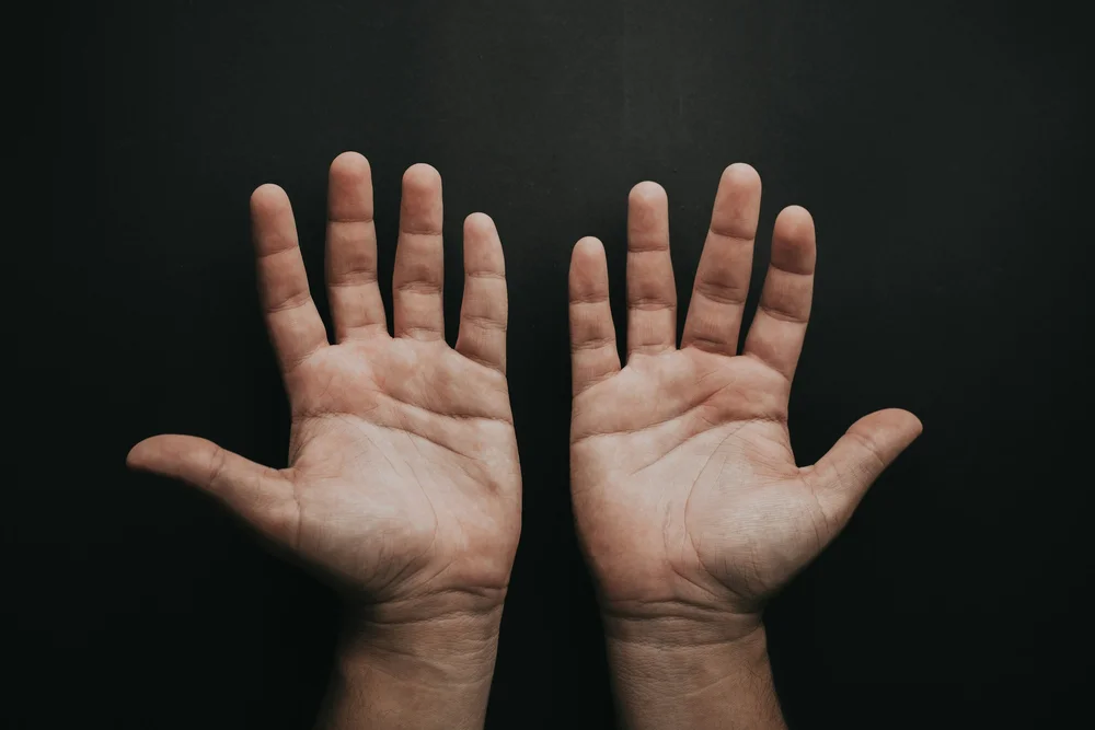 Rating Schedule for the Hand | Find out how the VA rates the hand and ...
