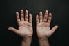 Rating Schedule for the Hand | Find out how the VA rates the hand and ...