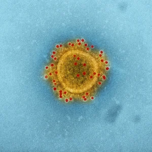 Rating Schedule for Infectious Diseases & Immune Disorders | Find out ...