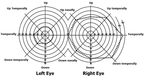Rating Schedule for The Eyes — Veterans Benefits Knowledge Base