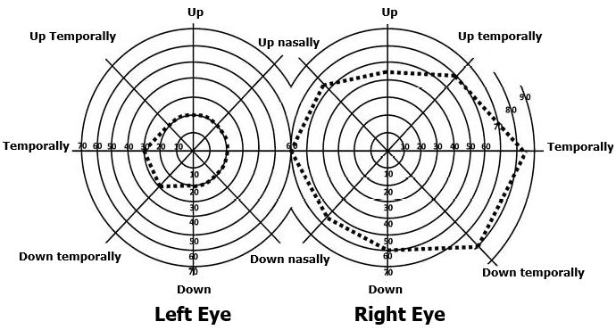 Rating Schedule for The Eyes | Find out how the VA rates the Eyes and ...