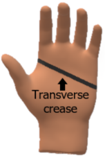 Rating Schedule for the Hand — Veterans Benefits Knowledge Base