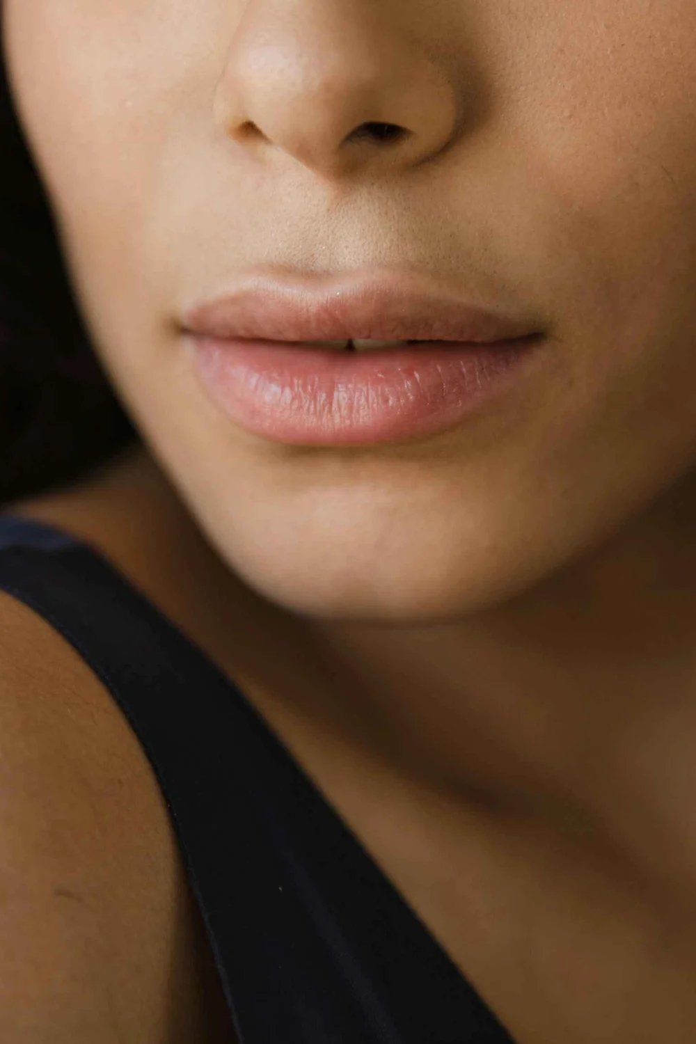 Lip Enhancement in Denver | Fuller, Natural-Looking Lips with Dr. Aline ...