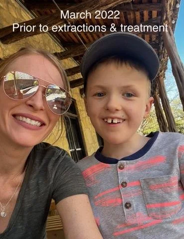 Invisalign : What the Process Looks like for our children — Meghan Weaver