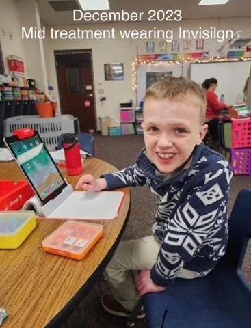 Invisalign : What the Process Looks like for our children — Meghan Weaver