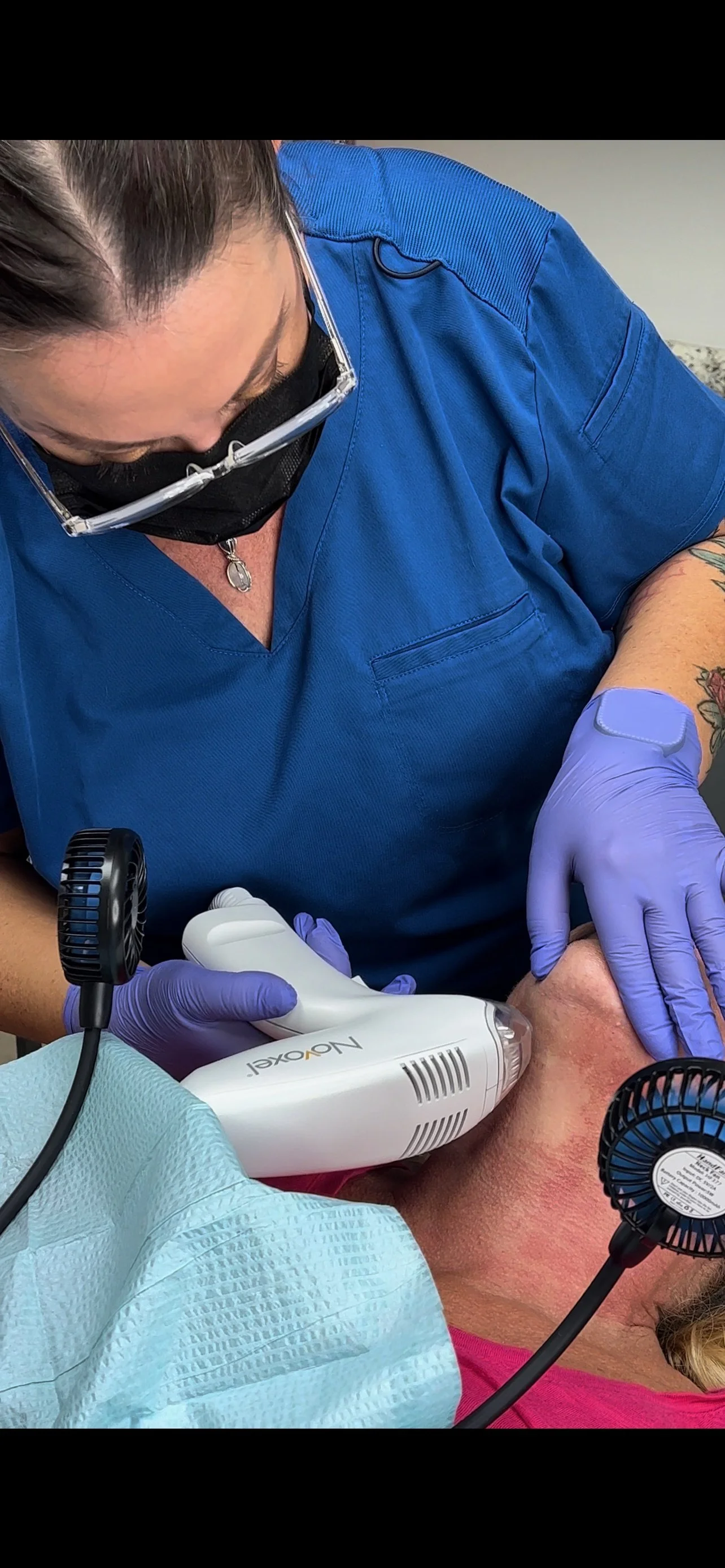 Tixel Before & After Portfolio | Marco Island Aesthetics — Marco Island Aesthetics