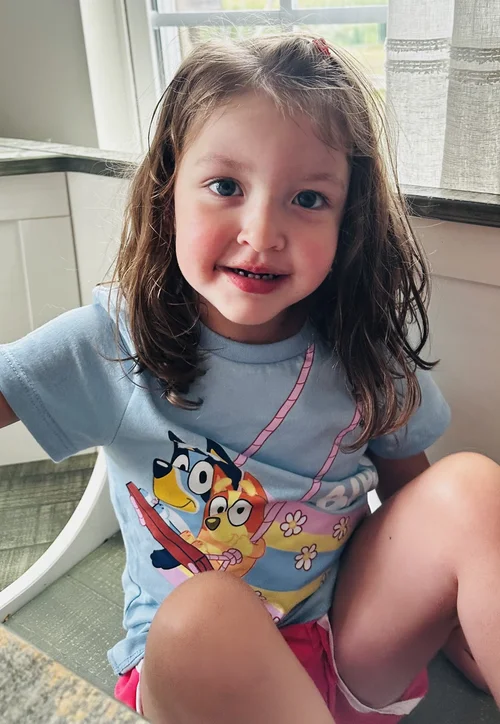 Photo Gallery — RNU4-2 / ReNU Syndrome