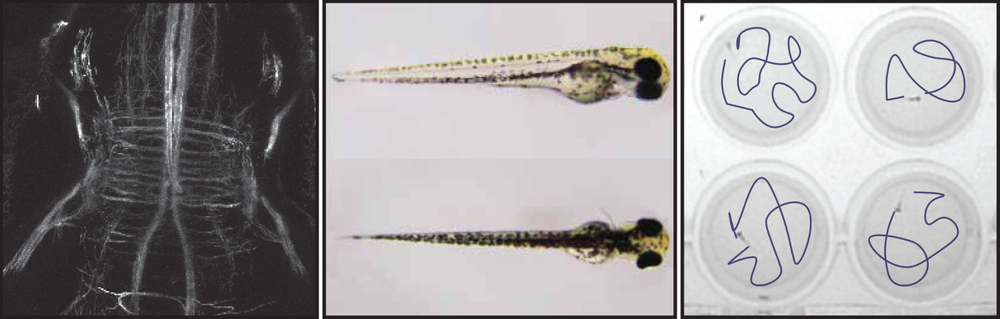 Research Opportunities — RNU4-2 / ReNU Syndrome