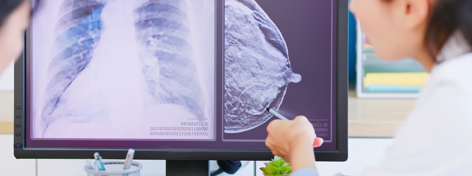 Understanding Breast Density: What You Need to Know About Your Mammogram