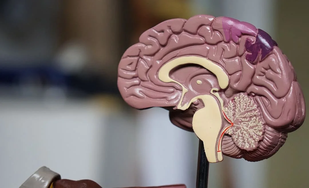 High Resolution Brain SPECT Imaging of Marijuana Smokers with AD/HD ...