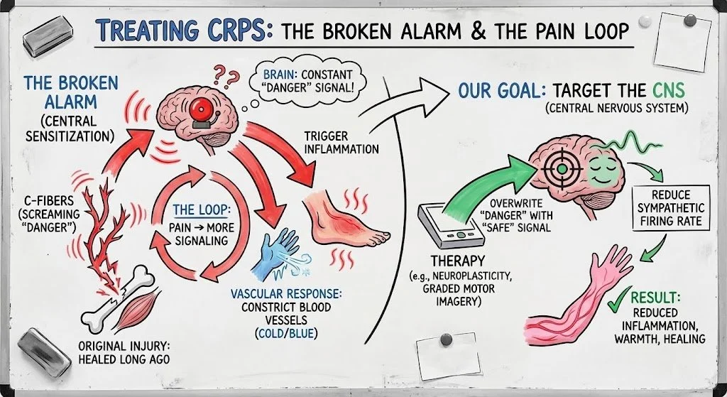 CRPS / RSD Remission Protocol — HyperCharge Health — Integrative Health ...
