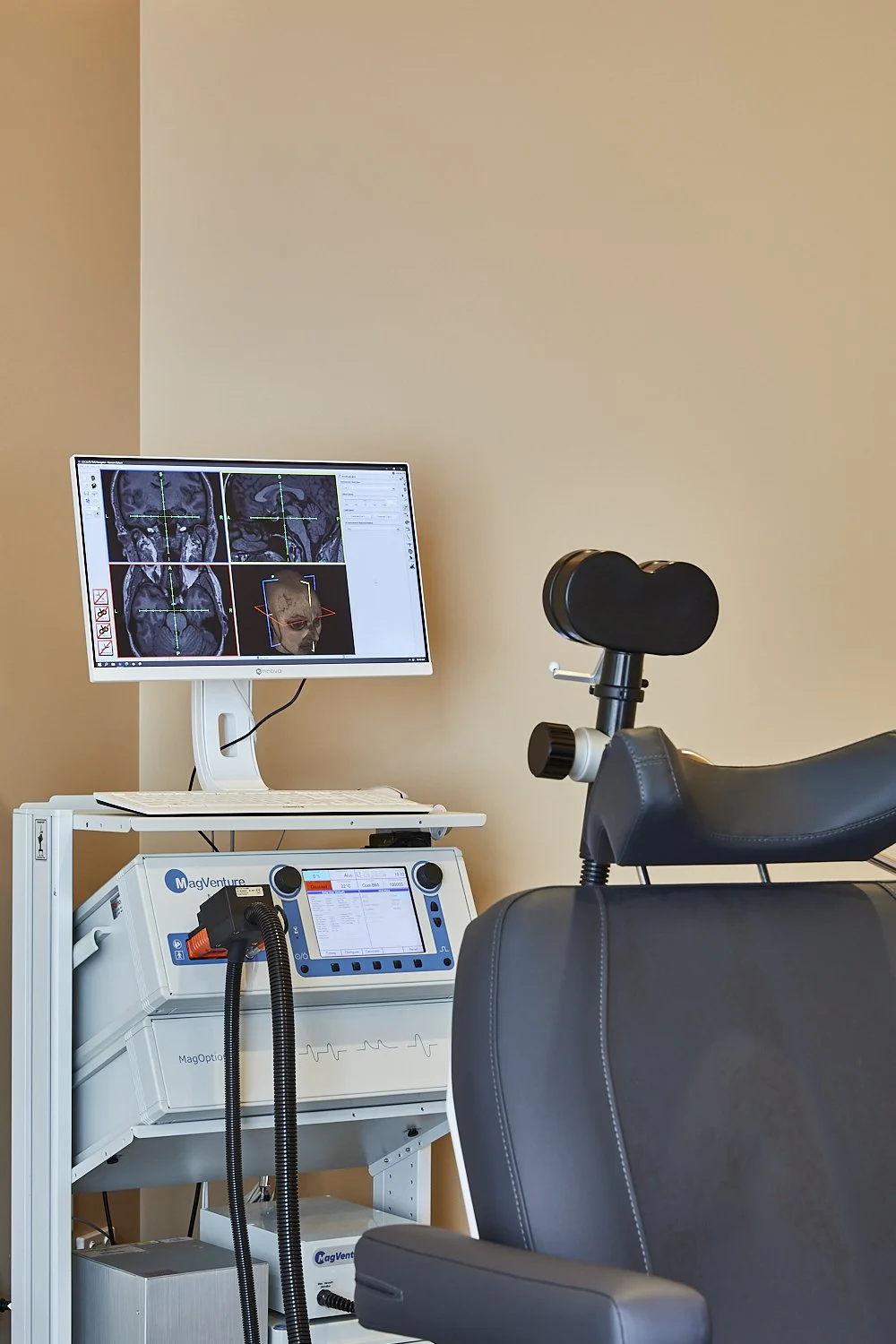 Cingulum Cingulum Sydney | TMS Treatment Sydney | Unlock New Pathways ...